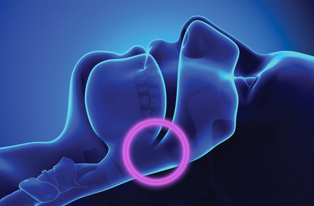 Signifier Medical Technologies
